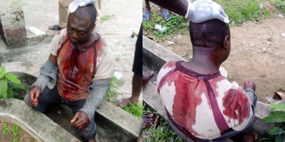 Police Arrest Two In Connection With Attack On Abua/Odual CDC Chairman ...